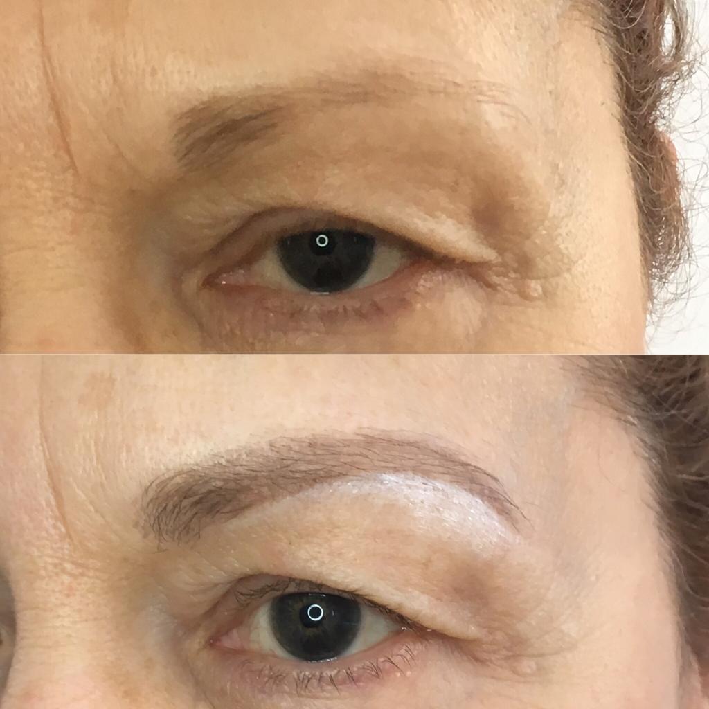 Are your brows still asymmetrical? - Rae Denman