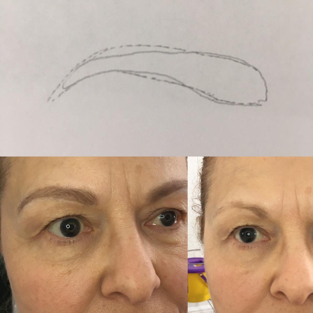 Are your brows still asymmetrical? - Rae Denman